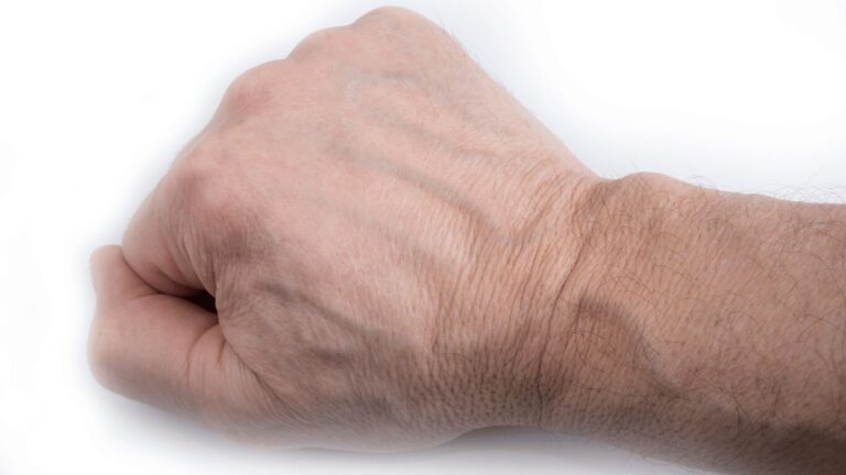 Blood Clot In Hand Vein: Causes & Treatment