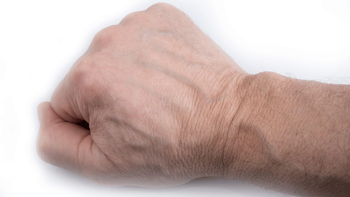 Blood Clot In Hand Vein: Causes & Treatment